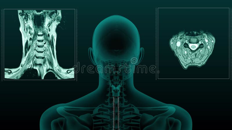 X-ray Scan of the Human Head and Neck with the Larynx Visible. 3d ...