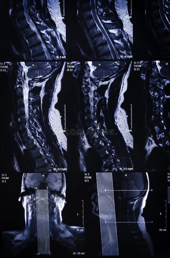 115 Mri Healthy Neck Stock Photos - Free & Royalty-Free Stock Photos ...