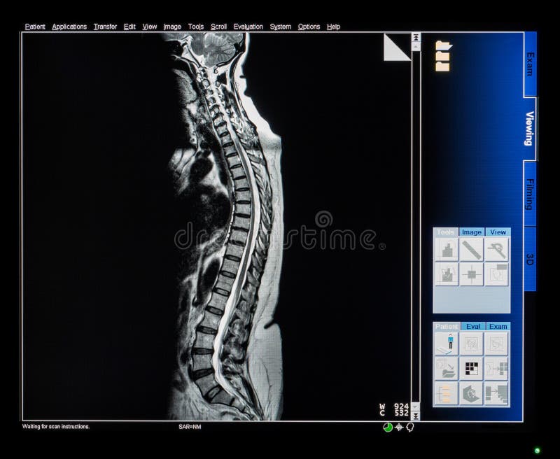 Mri of a backbone stock image. Image of examine, medical - 8940803