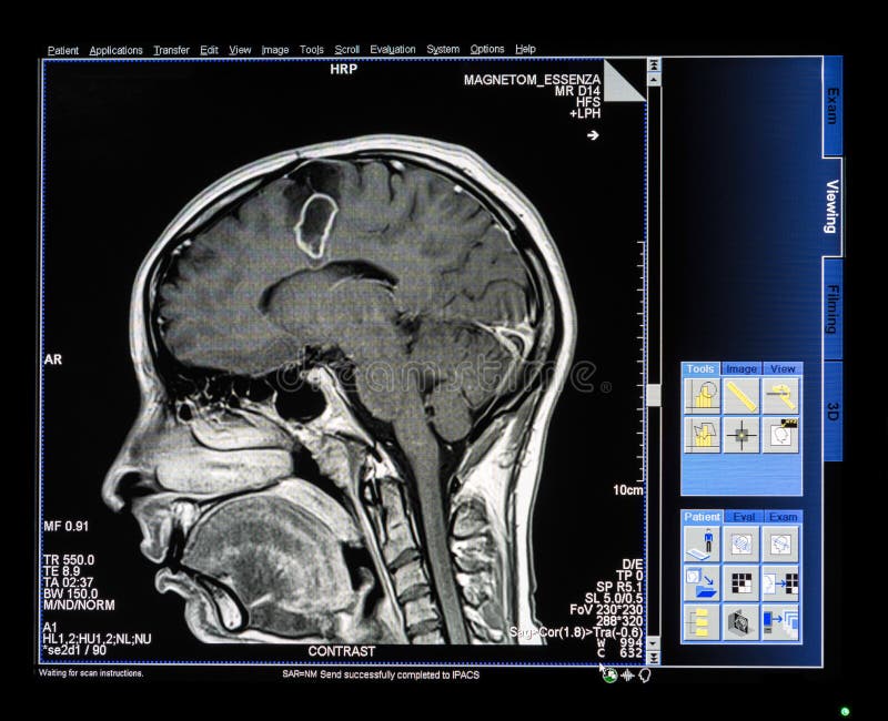 Mri Scan Monitor stock image. Image of brain, examination - 89807105