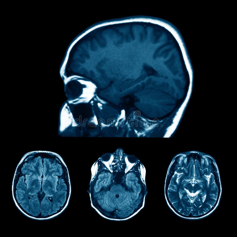 Mri scan stock photo. Image of care, patient, neurology - 53006174