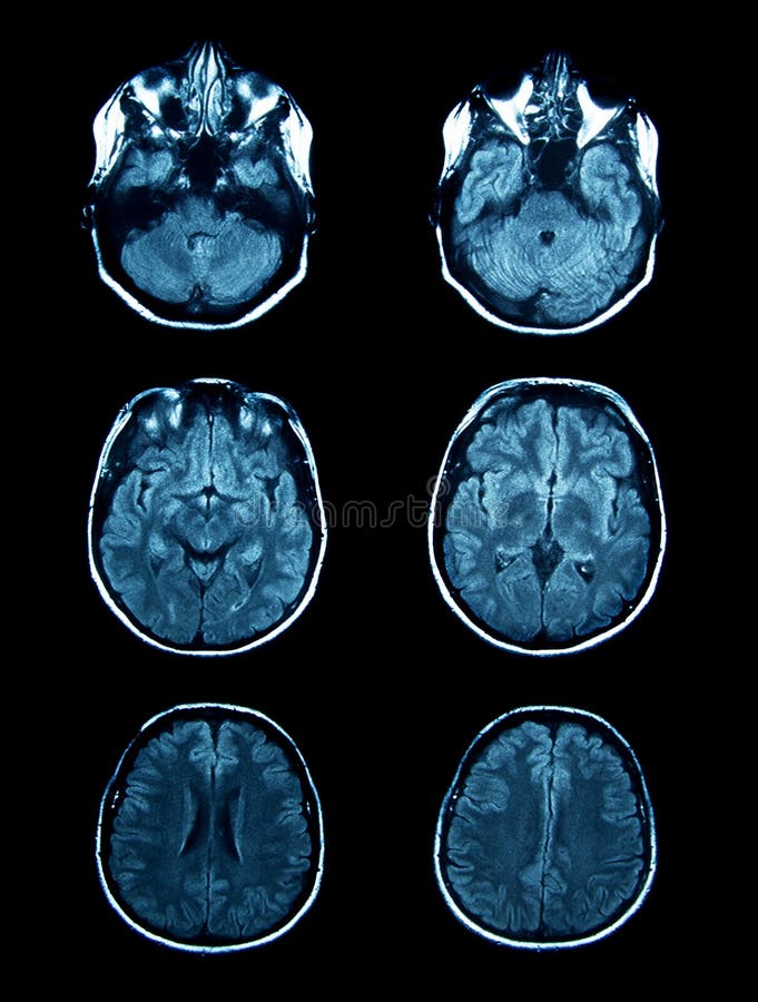 Mri scan stock image. Image of exam, skull, examination - 50546863