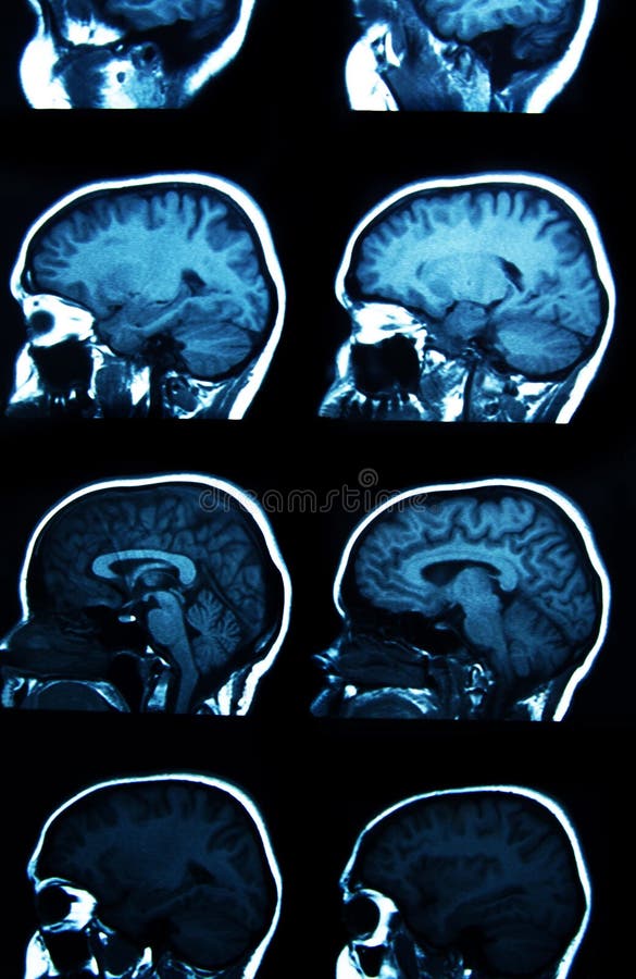 Mri scan stock photo. Image of resonance, bone, neurology - 53816670