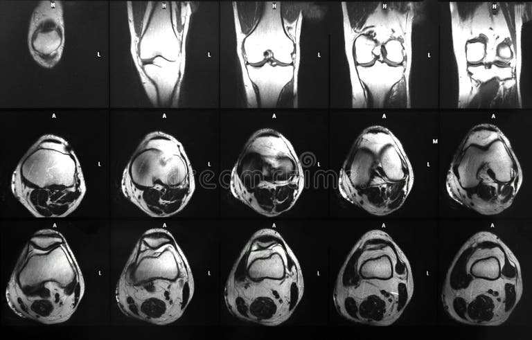 Knee Mri Clip Art Stock Photos - Free & Royalty-Free Stock Photos from ...