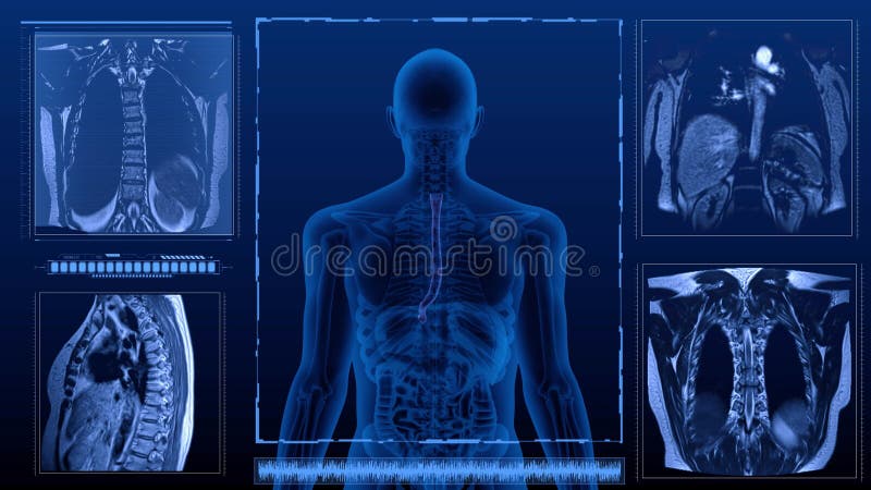 MRI Tomography Scan in Different Projections of the Human Digestive ...