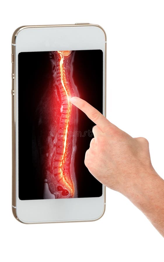 MRI Whole Body Scans are Beneficial for Early Cancer Detection ... MRI Whole Body Scans are Beneficial for Early Cancer Detection ...