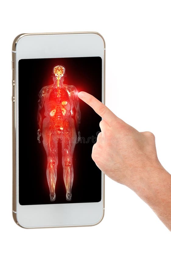 MRI Whole Body Scans are Beneficial for Early Cancer Detection ... MRI Whole Body Scans are Beneficial for Early Cancer Detection ...