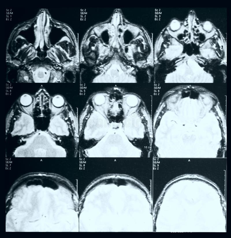 MRT stock photo. Image of resonance, radioactive, film - 12178250