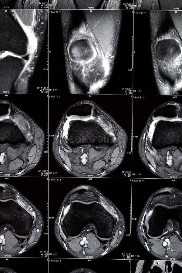 MRT Scan stock photo. Image of hinge, center, joint, picture - 15747116