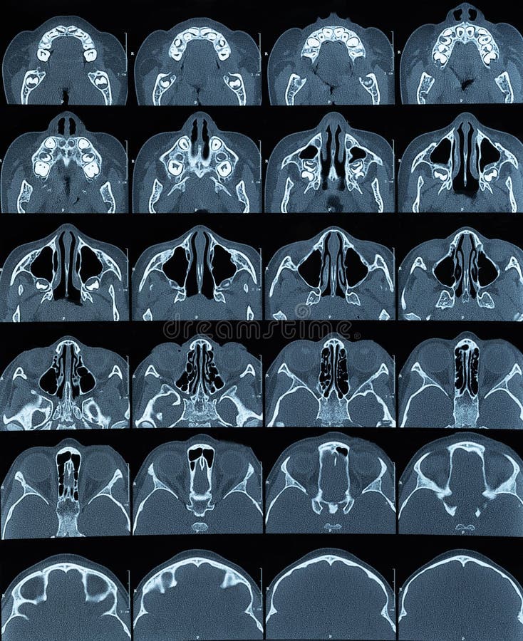 MRT scan of head stock image. Image of screen, virtual - 278117697