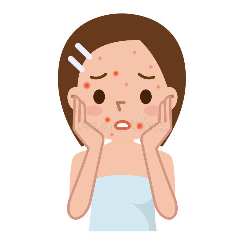 Muchacha Fea De La Piel Del Problema Ilustración del Vector ...