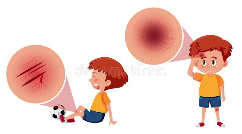 Herida Ilustraciones Stock, Vectores, Y Clipart – (17,846 Ilustraciones ...