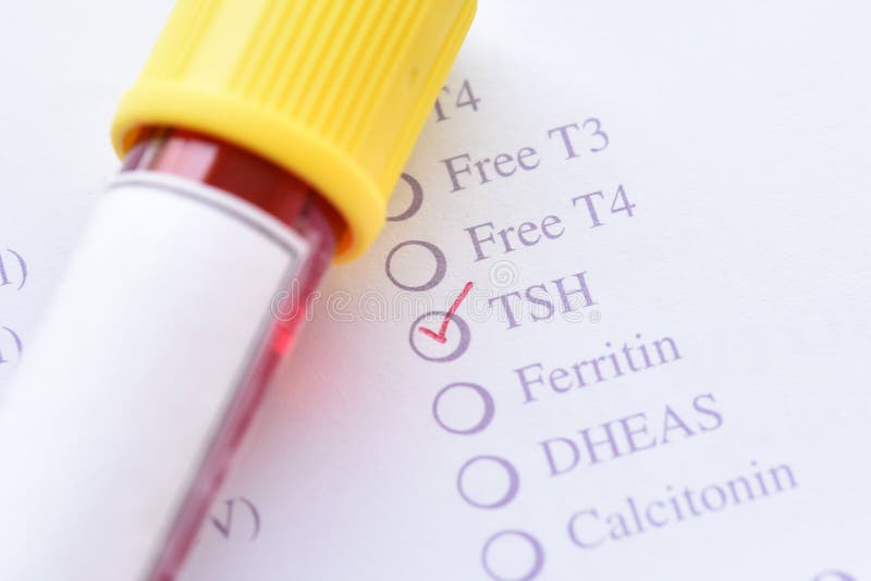 Resultado De La Prueba De Hipertiroidismo Foto de archivo - Imagen de ...