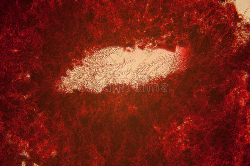 Muffa al microscopio fotografia stock. Immagine di funghi - 111147308