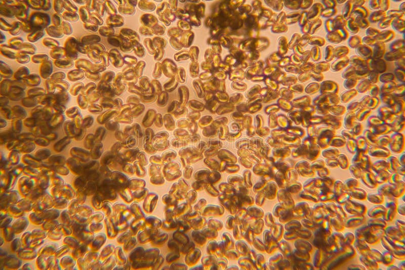 Muffa al microscopio fotografia stock. Immagine di funghi - 111147308