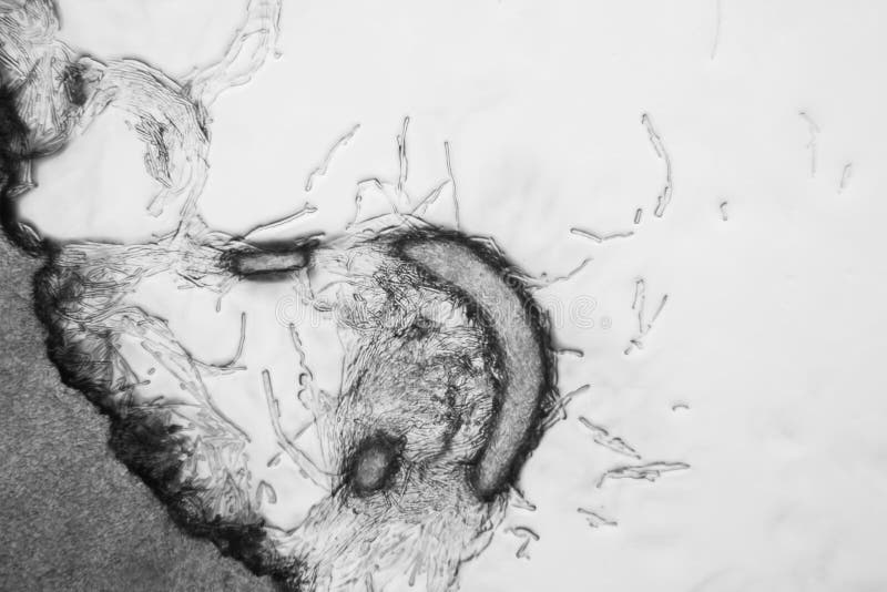 Muffa al microscopio fotografia stock. Immagine di funghi - 111147308