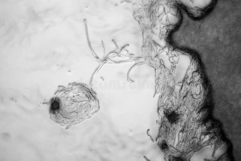 Muffa al microscopio immagine stock. Immagine di petri - 111147281