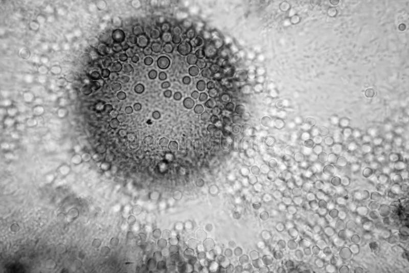 Muffa al microscopio fotografia stock. Immagine di fungoso - 111147678