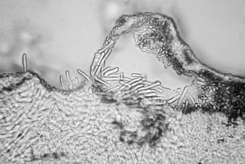 Muffa al microscopio immagine stock. Immagine di petri - 111147281