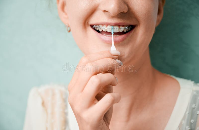 Jovencita Alegre Con Cordones En Los Dientes Mirando En El Espejo Foto
