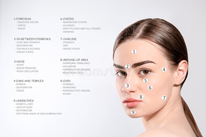 Mujer Joven Con El Mapa De La Cara Del Acné Foto de archivo - Imagen de ...