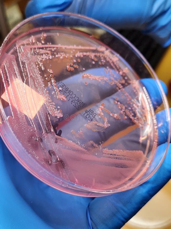 Multi-drug Resistant Acinetobacter Bacteria on Petri Dish -Macconkey ...