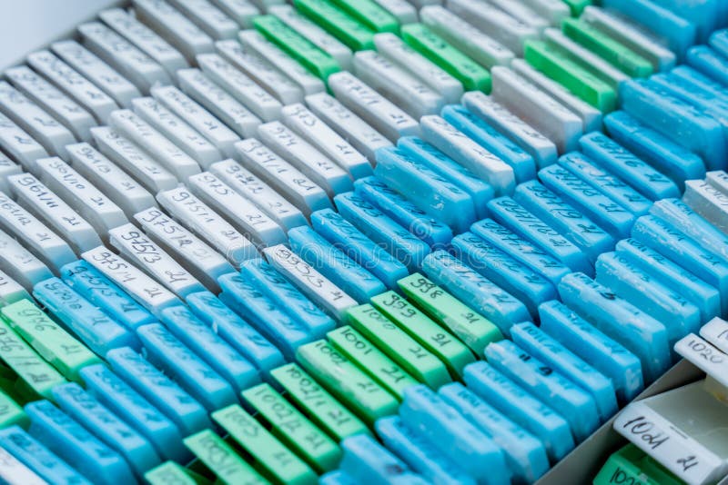 Multicolored Patient Tissue Blocks at Modern Laboratory Stock Image ...