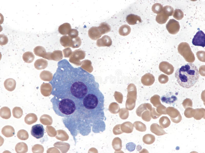 Multinucleated Plasma Cell Stock Photos - Free & Royalty-Free Stock ...