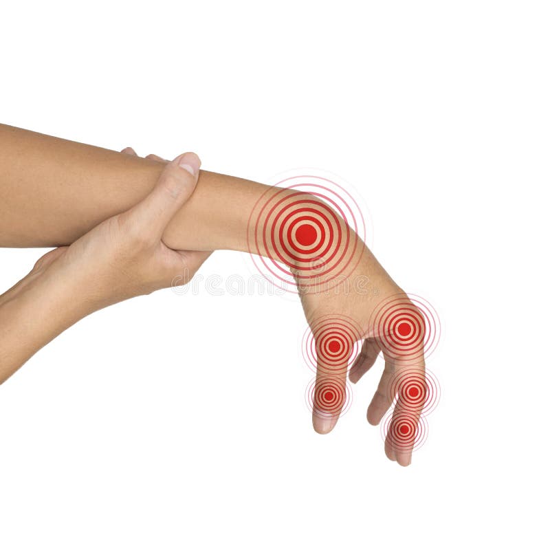 Multiple Joints Inflammation. Concept of Rheumatic Arthritis ...