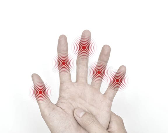 Multiple Joints Inflammation. Concept of Rheumatic Arthritis ...