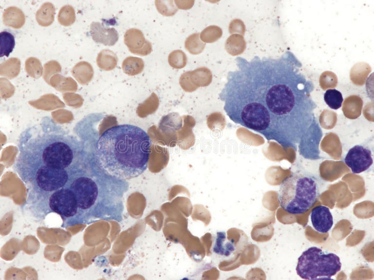 Plasma Cells Stock Illustrations – 8,748 Plasma Cells Stock ...