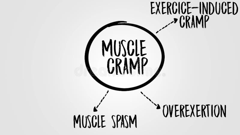 Muscle Cramp is a Sudden, Unexpected Tightening of One or More Muscle, Mind Map Text Concept ...