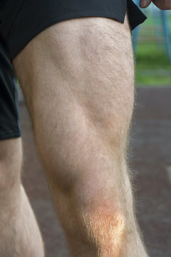 Muscle leg stock image. Image of athletic, healthy, athlete - 55248497