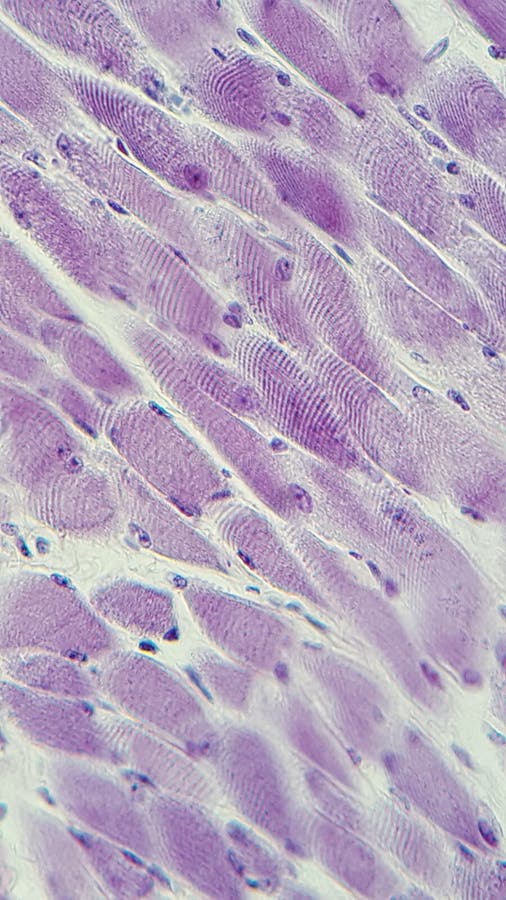 Muscle Striated Voluntary Microphotography Under Optic Microscope Stock ...
