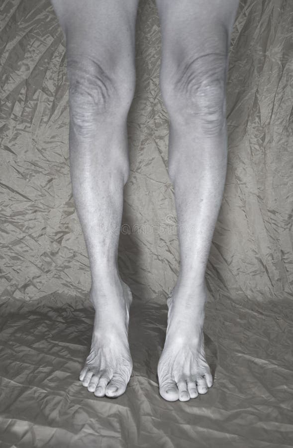 The Muscles of the Legs of the Elderly with Atrophy Stock Image - Image ...