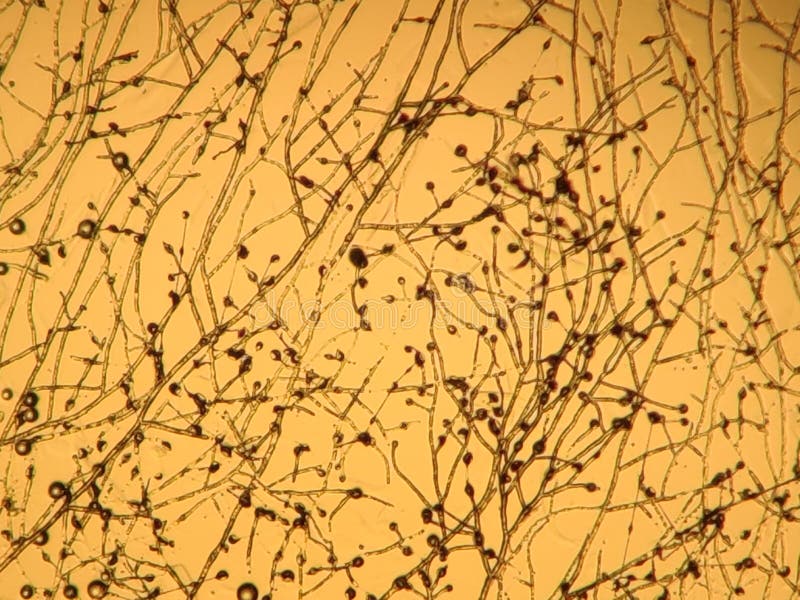 The Mycelium of a Dermatophyte Fungus Under the Microscope Stock Photo ...