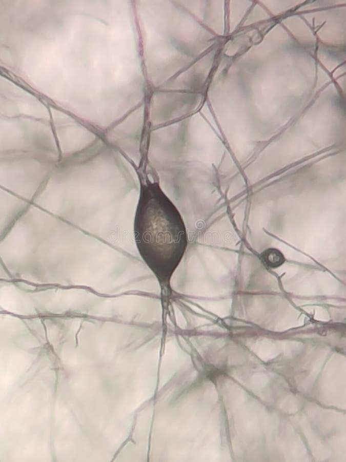The Mycelium of a Dermatophyte Fungus Under the Microscope Stock Photo ...