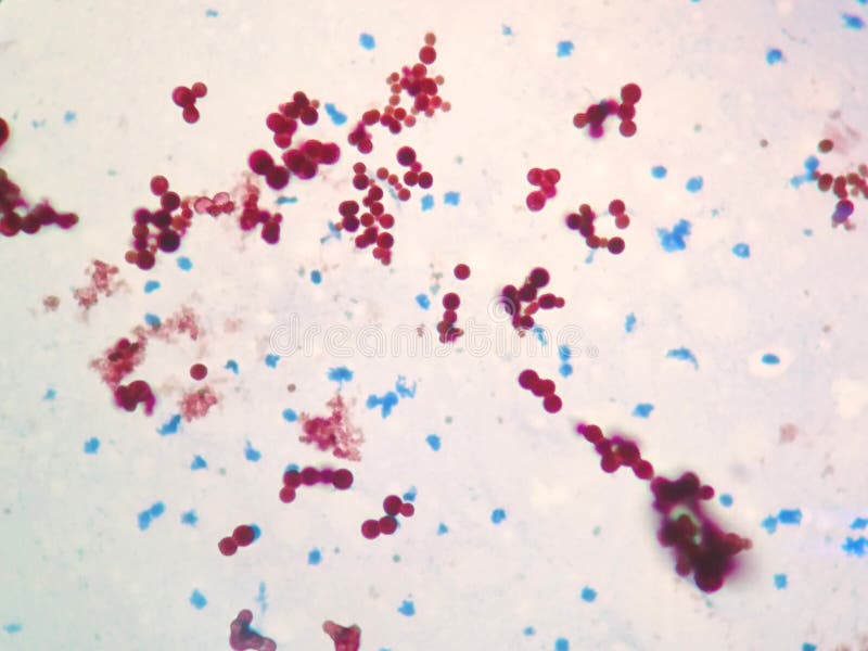 Mycobacterium stock photo. Image of medical, macro, infection - 89484968