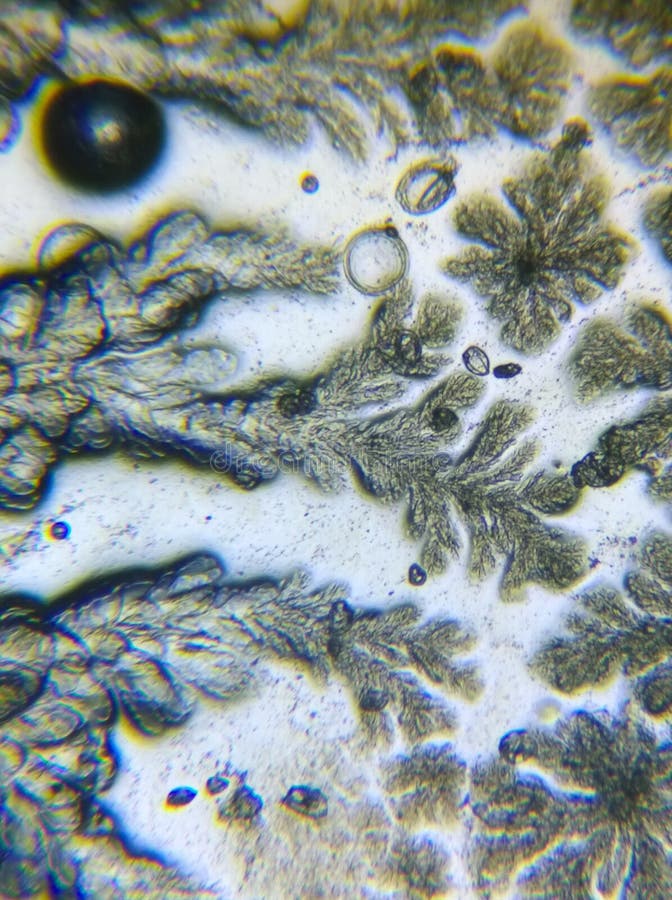 Bacillus Subtilis Beautiful Bacterial Growth Under the Microscope Stock ...