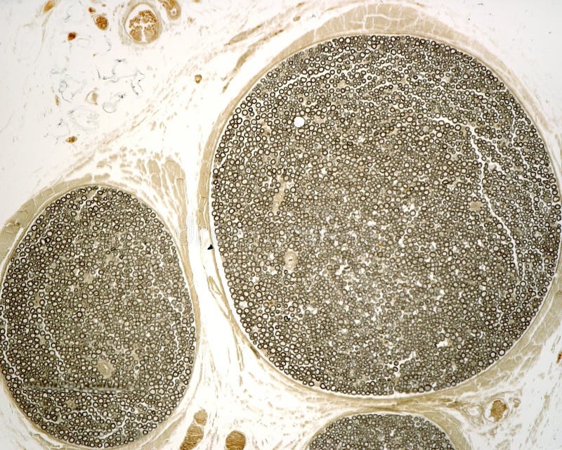 Myelinated Nerve Fibers. Osmiums Tetroxyde Stock Photo - Image of ...