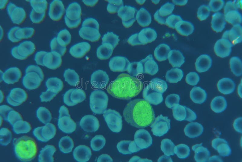 Myeloblast stock photo. Image of fluorescence, medical - 42788418