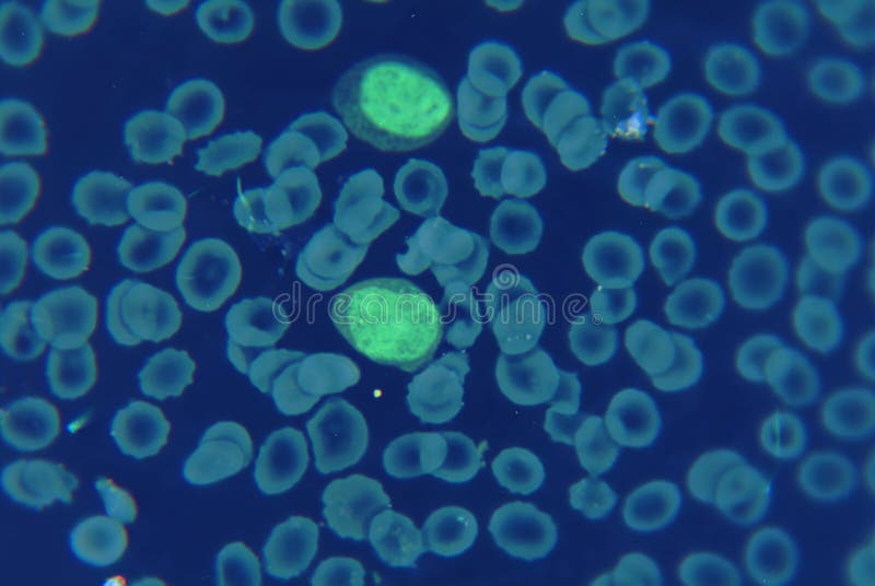 Myeloblast stock photo. Image of myeloblast, health, healthcare - 42788432