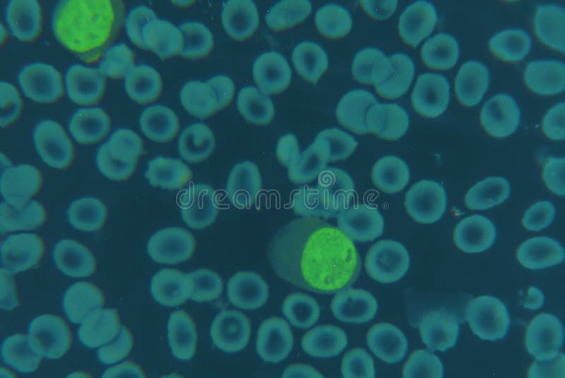 Myeloblast stock photo. Image of hemotolgy, cells, microscope - 42788442