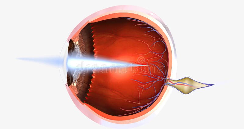 Myopia, is a Common Visual Condition in Which the Eye S Ability To ...