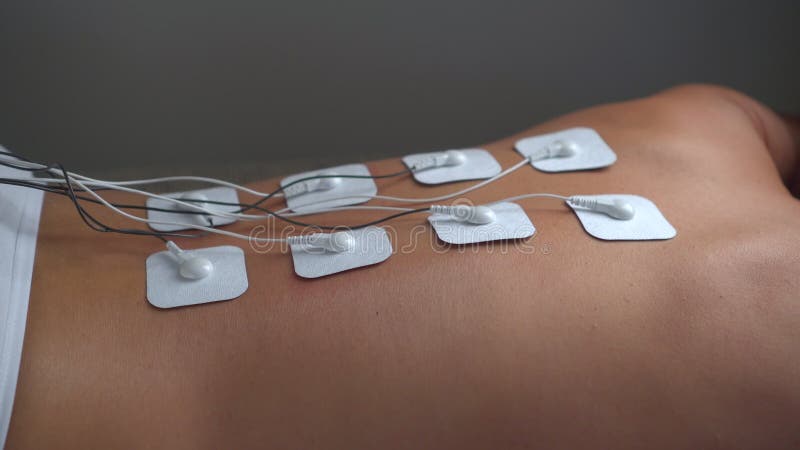 Physiotherapy of the Back with TENS Electrode Pads, External Electrical ...