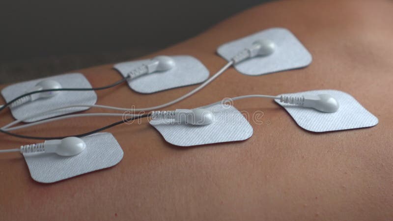 Myostimulation and Physical Therapy TENS of the Back, Electrical ...