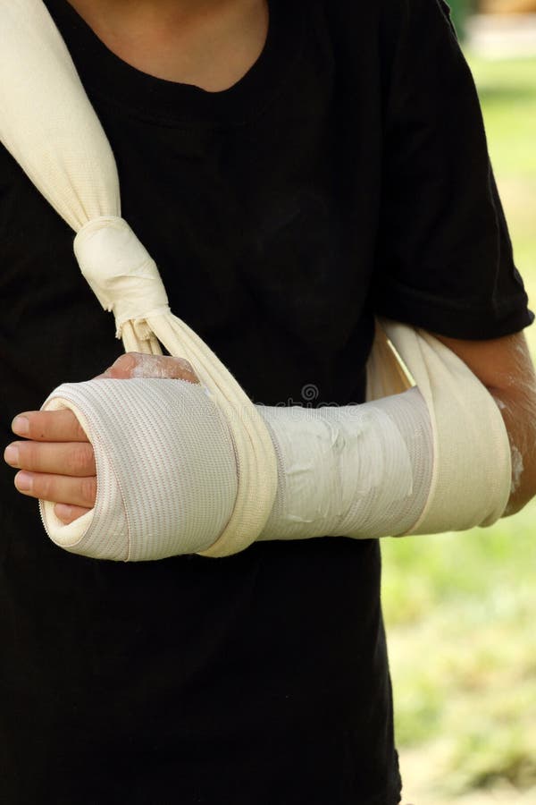 Naaste Jongen Met Gebroken Arm En Gips Stock Afbeelding - Image of pijn ...