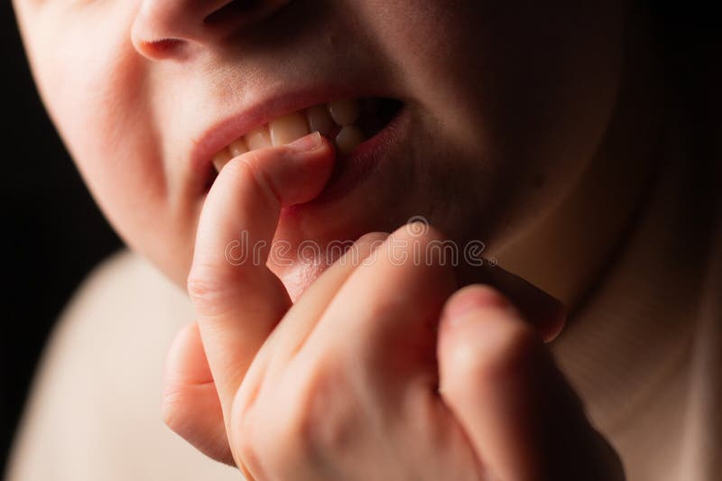 Nail Biting. Woman Biting Fingernails. Behavioral Disorder ...