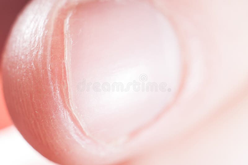 Nail on Human Finger Close Up, Macro Stock Photo - Image of dirty, hurt ...