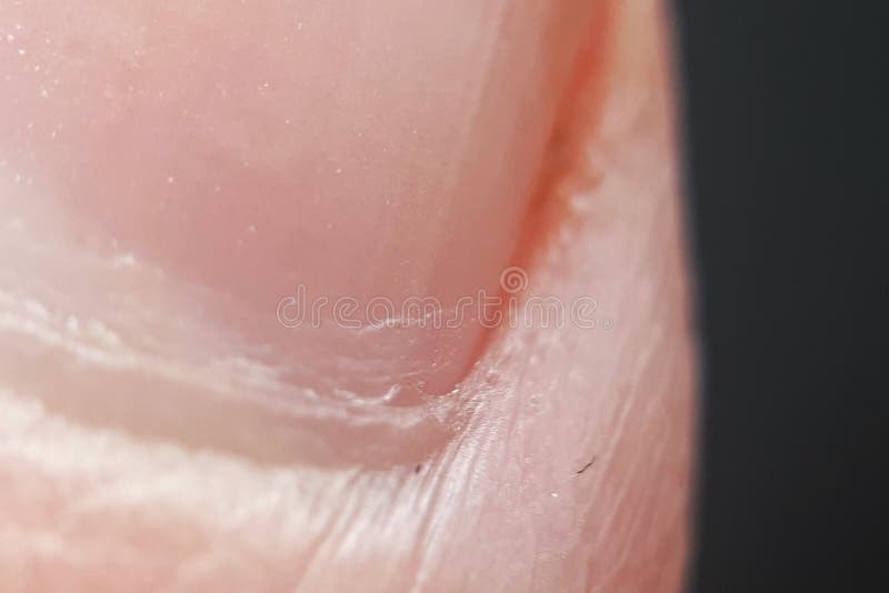 210 Human Fingernail Anatomy Stock Photos - Free & Royalty-Free Stock ...